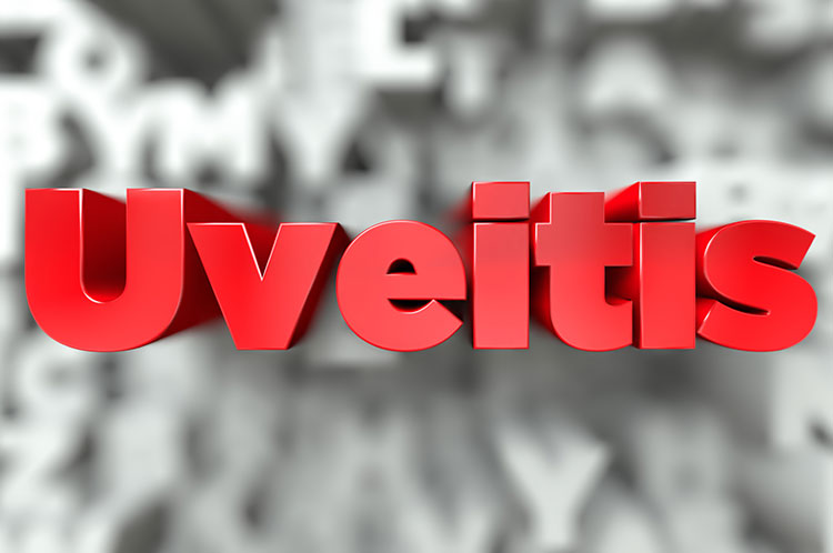 Consider These Best Practices in Patients with Uveitis - Ophthalmology 360