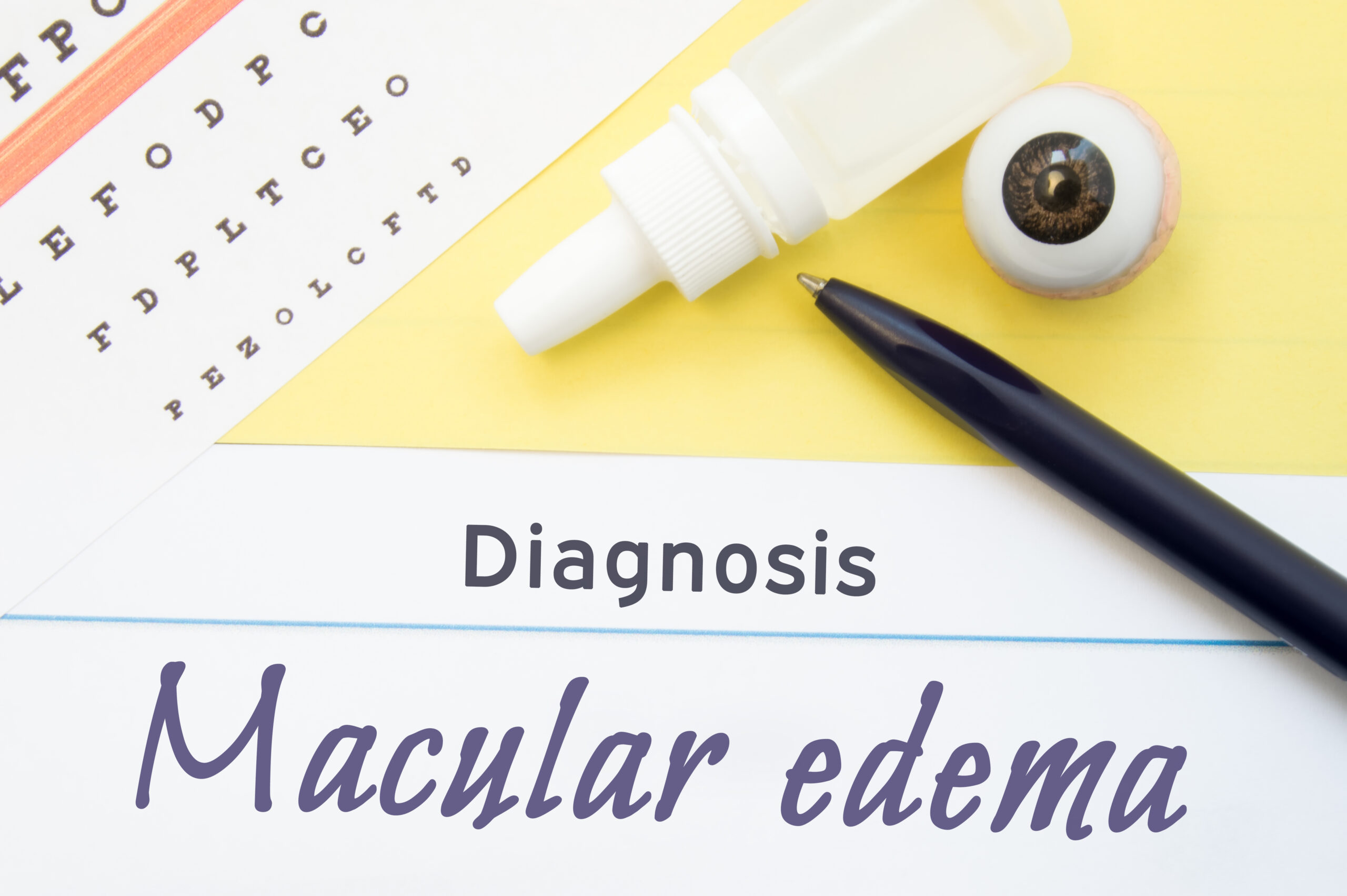 Persistent macular edema after anti-VEGF leads to worse outcomes in ...
