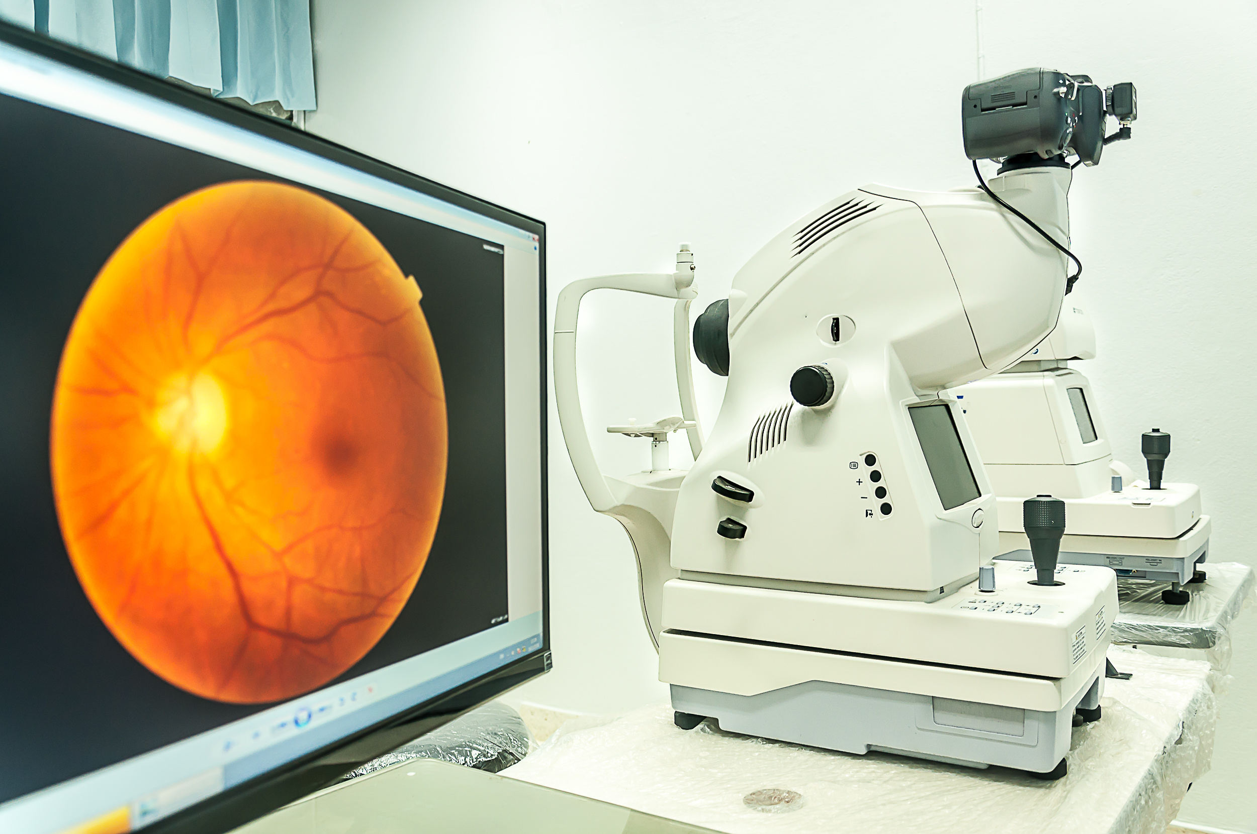 Episcleral brachytherapy for treatment resistant nAMD warrants deeper ...