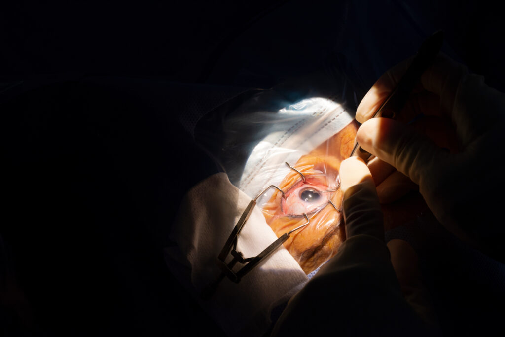 Intravitreal aflibercept shows potential in peripapillary pachychoroid ...