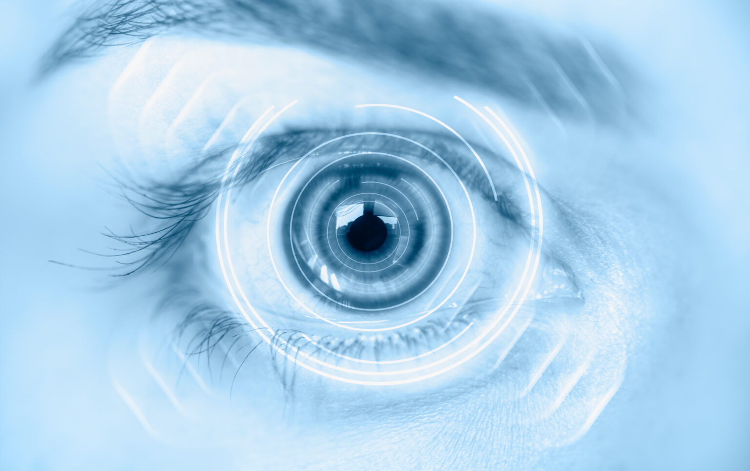 iPRIME Viscodelivery System: Increasing Precision and Visual ...