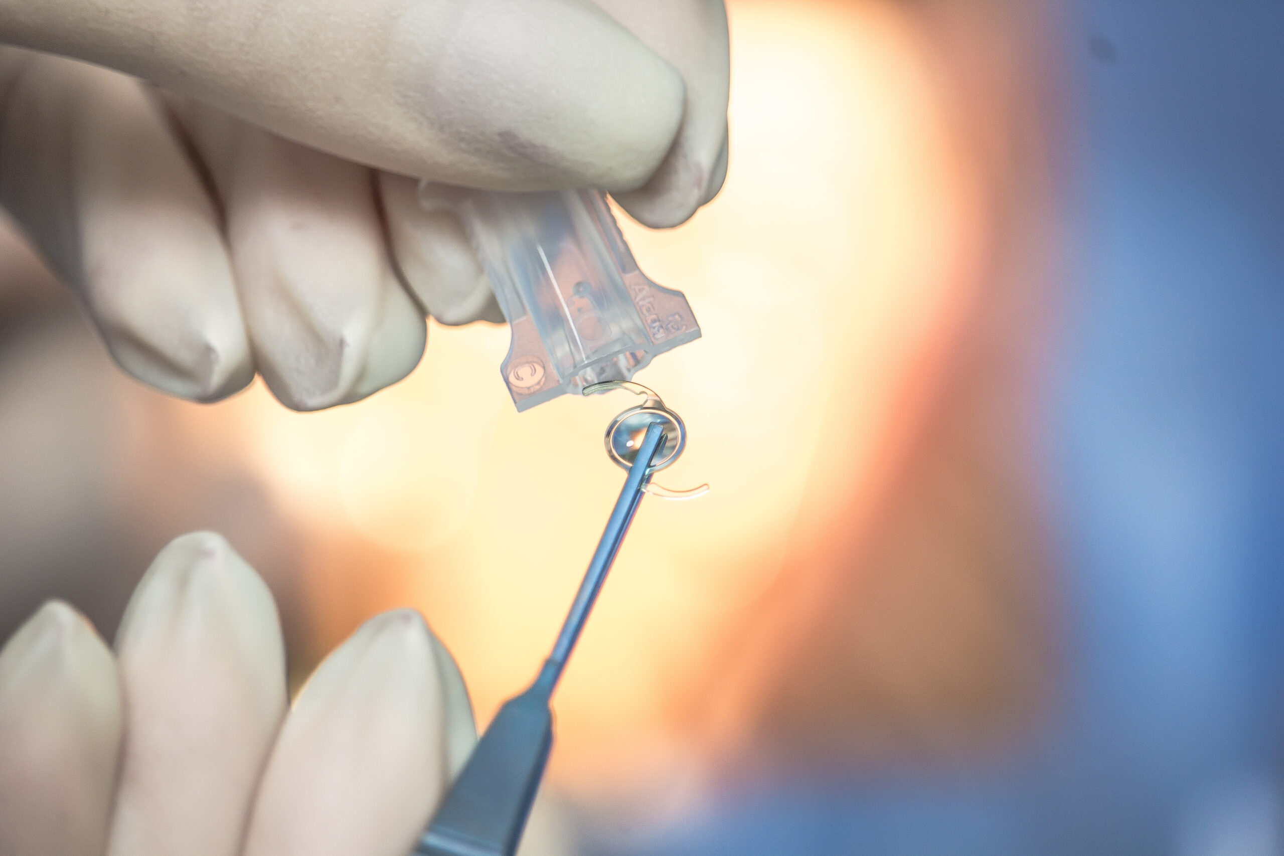 Anterior vitrectomy reduces complications in pediatric cataract surgery ...