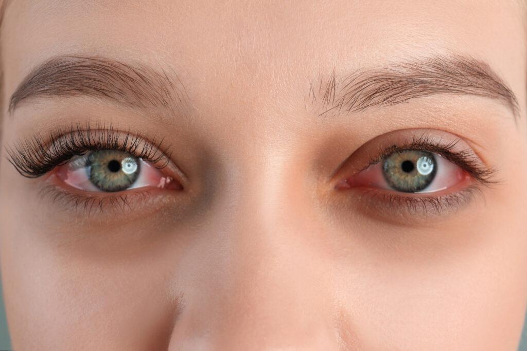 Phase 4 data demonstrates Cequa's sustained efficacy in dry eye disease ...
