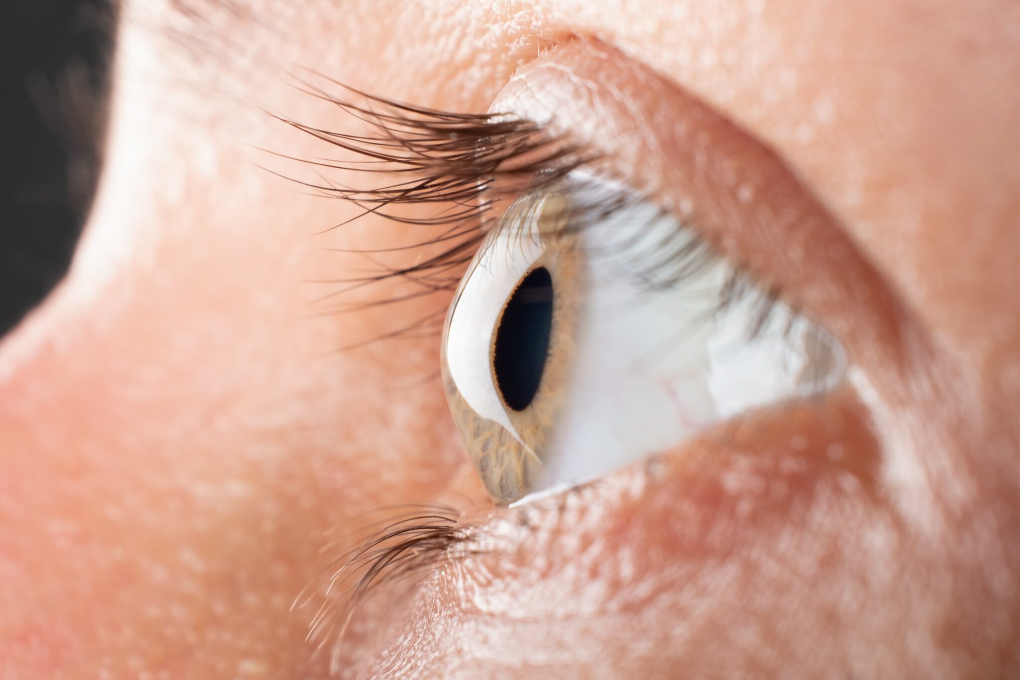 Corneal opacity is a major contributor to vision loss in the US, study ...