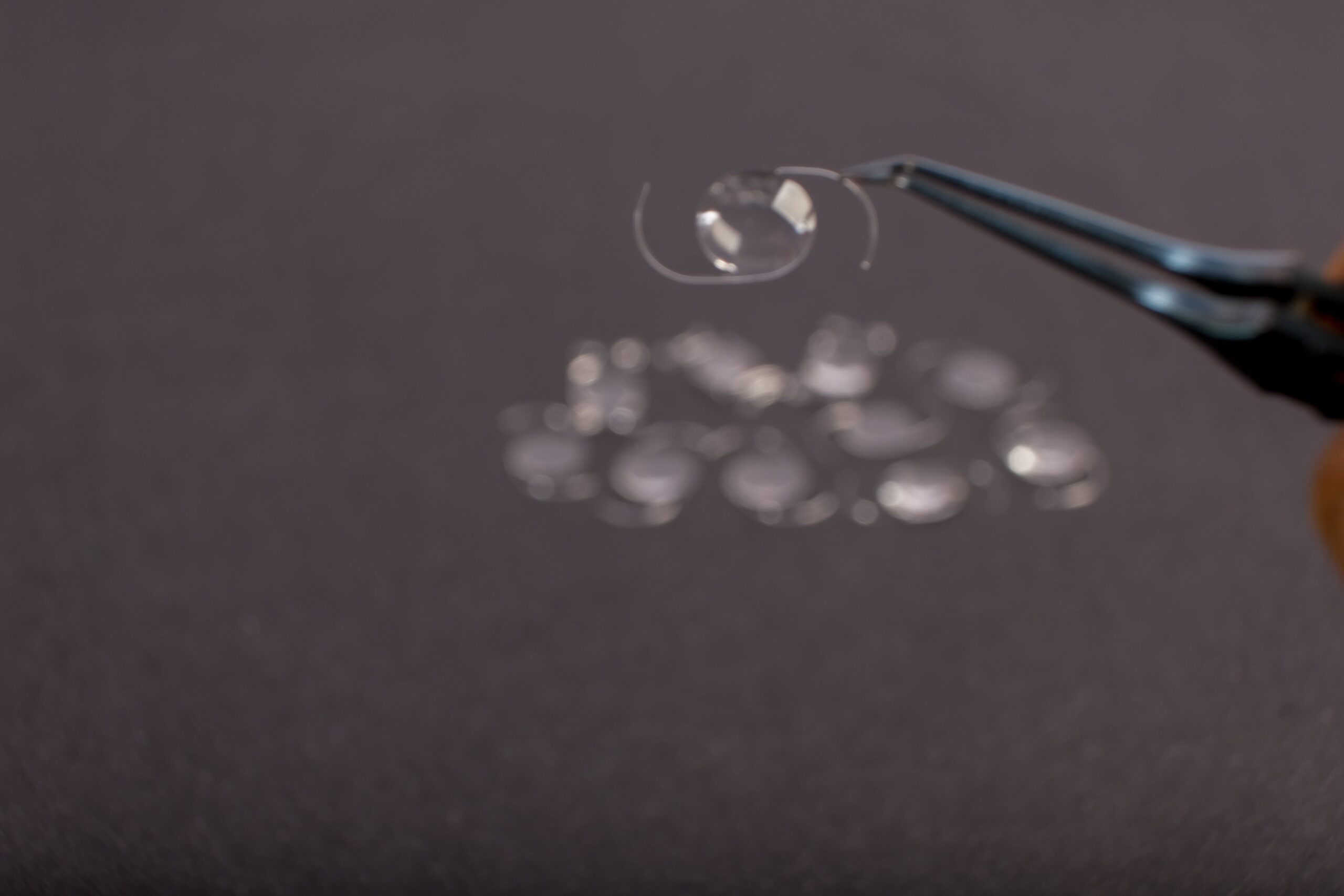 Multifocal lenses outperform monofocal implants in pediatric cataract ...